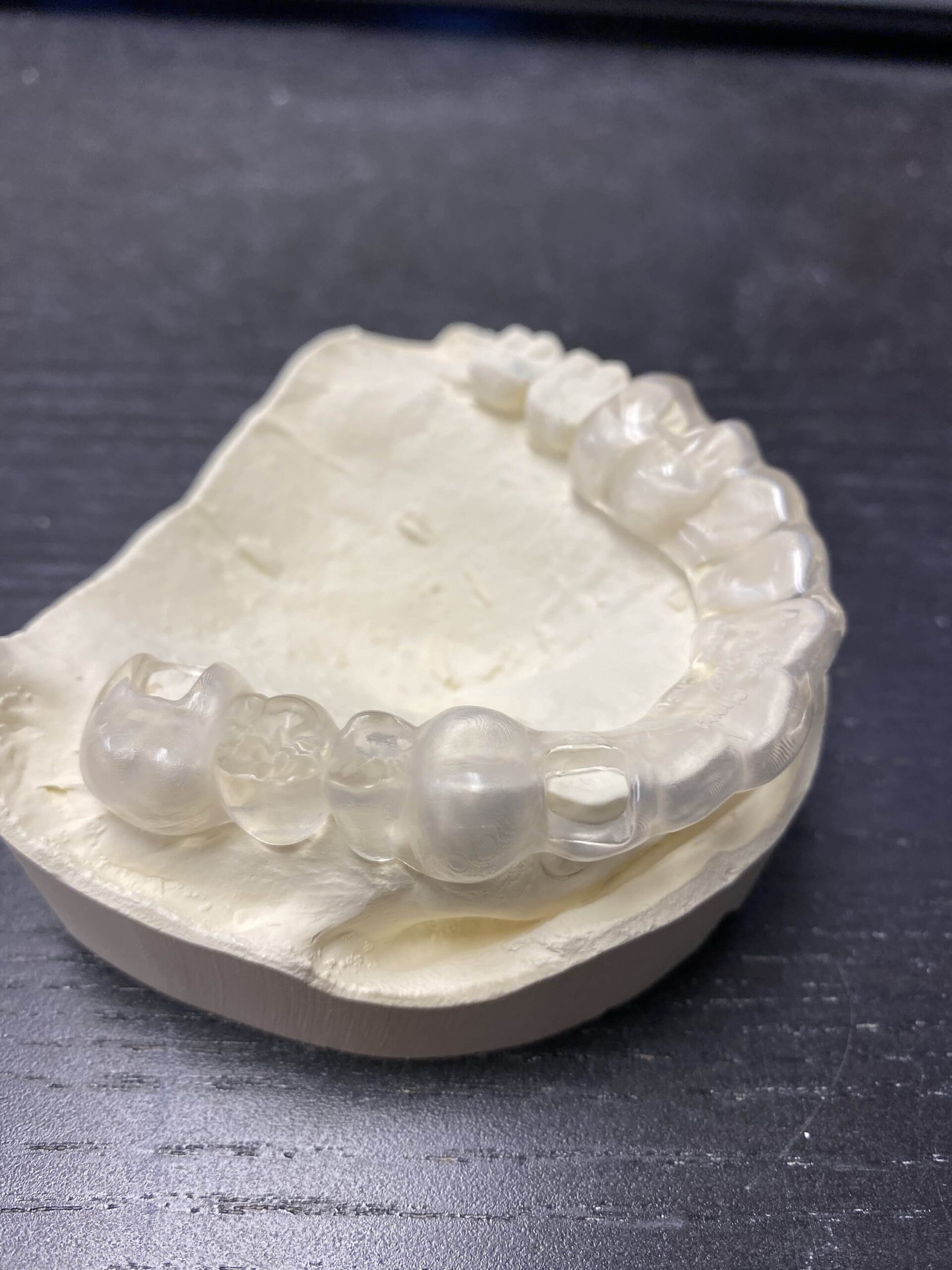 Implant – DigiPros Dental Laboratory