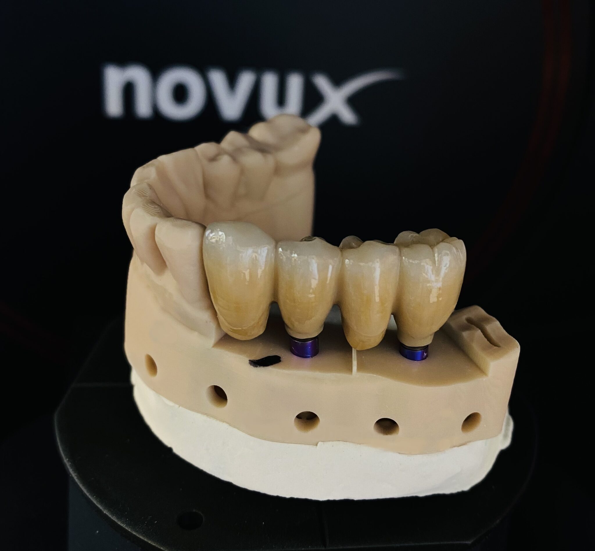 Implant – DigiPros Dental Laboratory