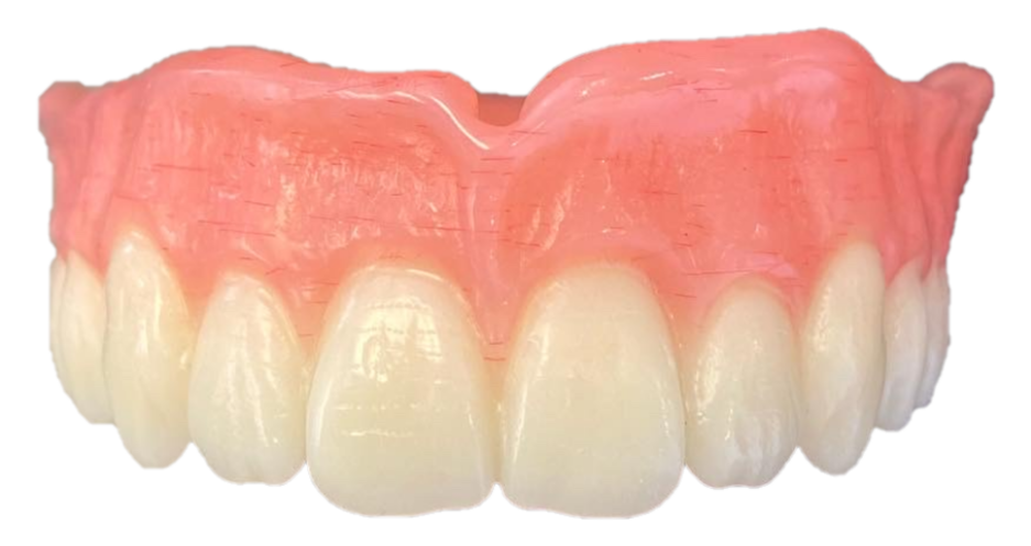 Removable Restorations – DigiPros Dental Laboratory